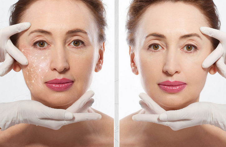 Naravna kozmetika ROSSEN Natural, Botox serum | Enaa